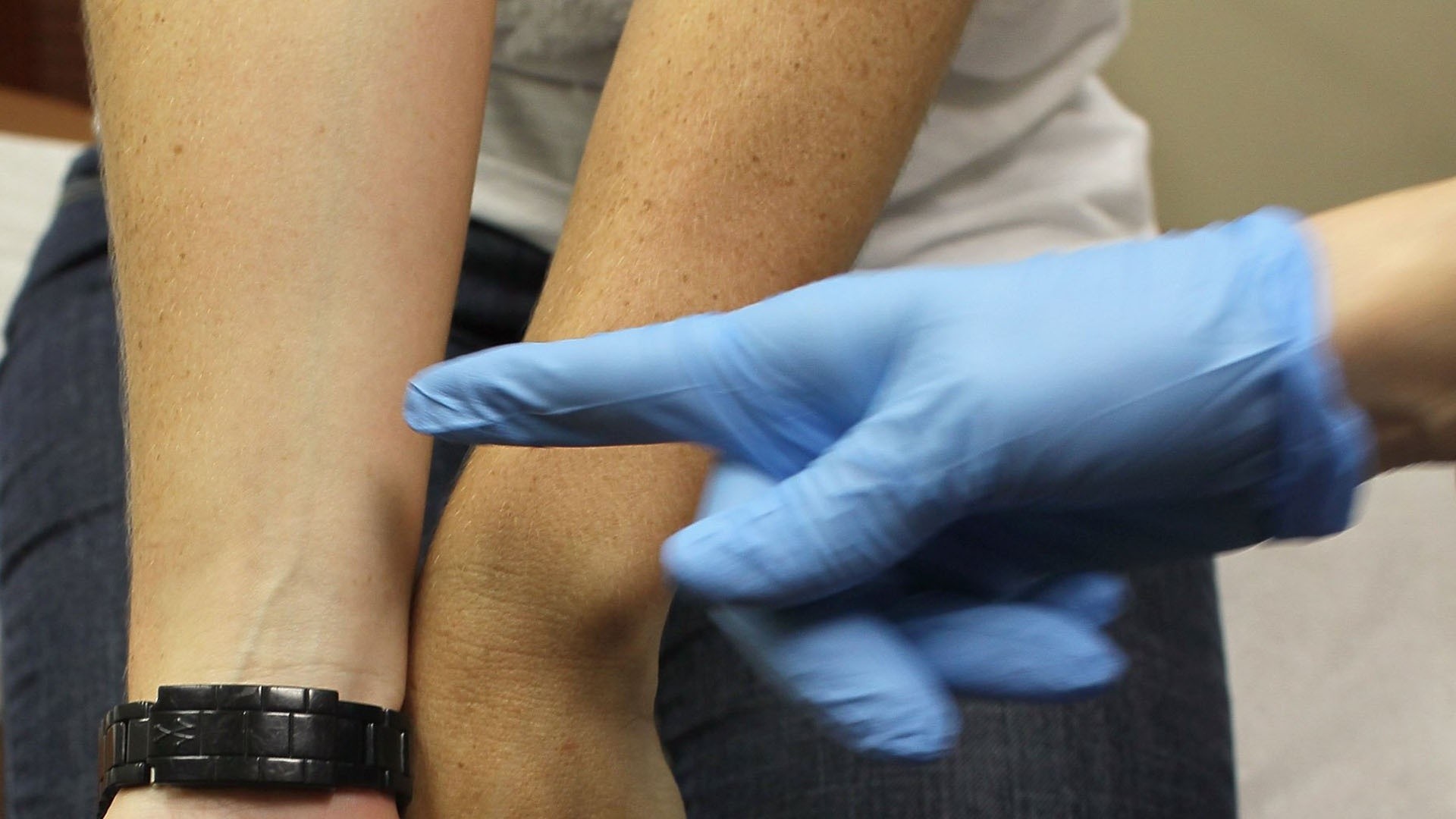 How is melanoma different from other skin cancers?