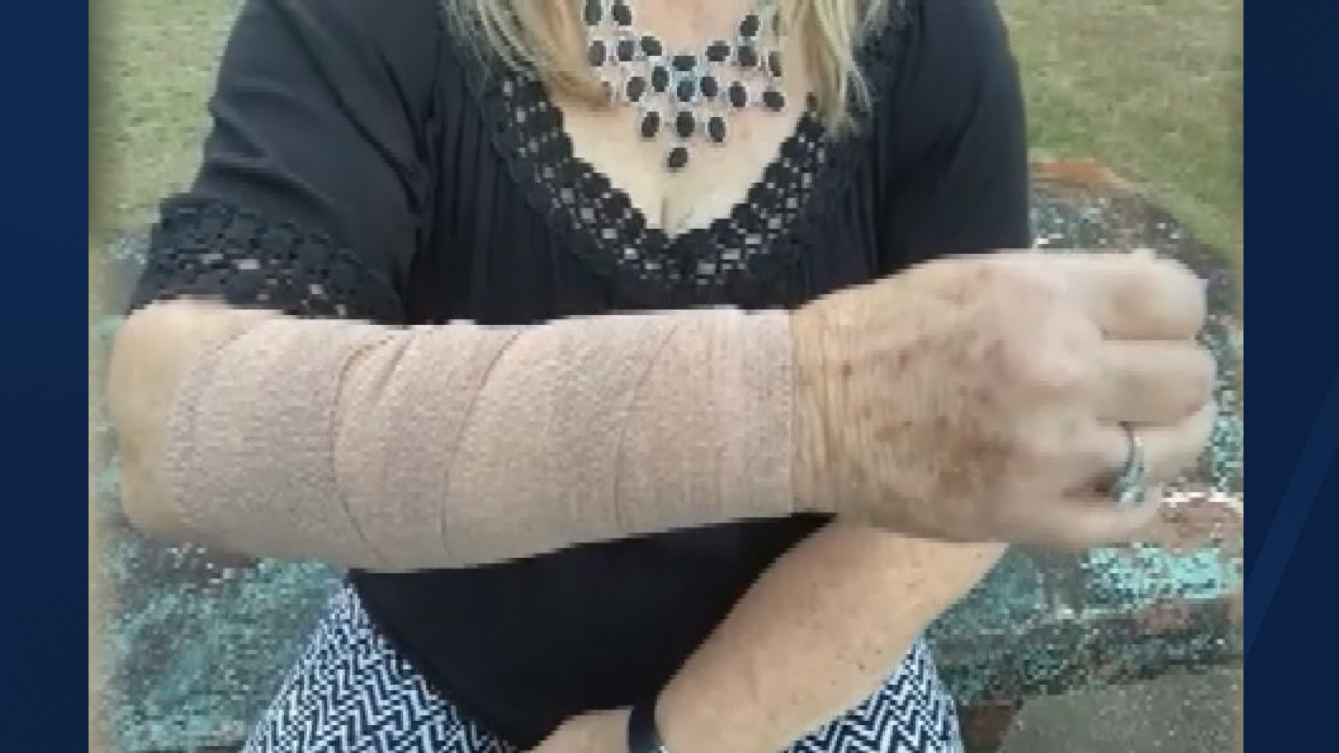 Fangs, feathers and talons: Snake & hawk attack Texas woman