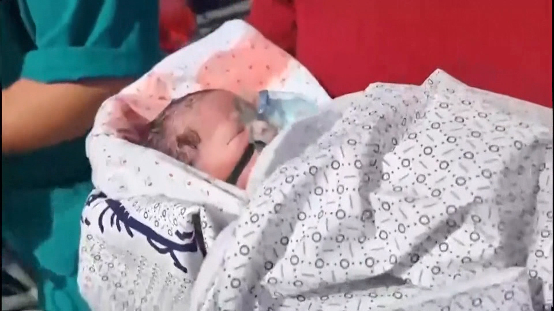 Baby delivered by emergency C-section after mother injured in a blast ...