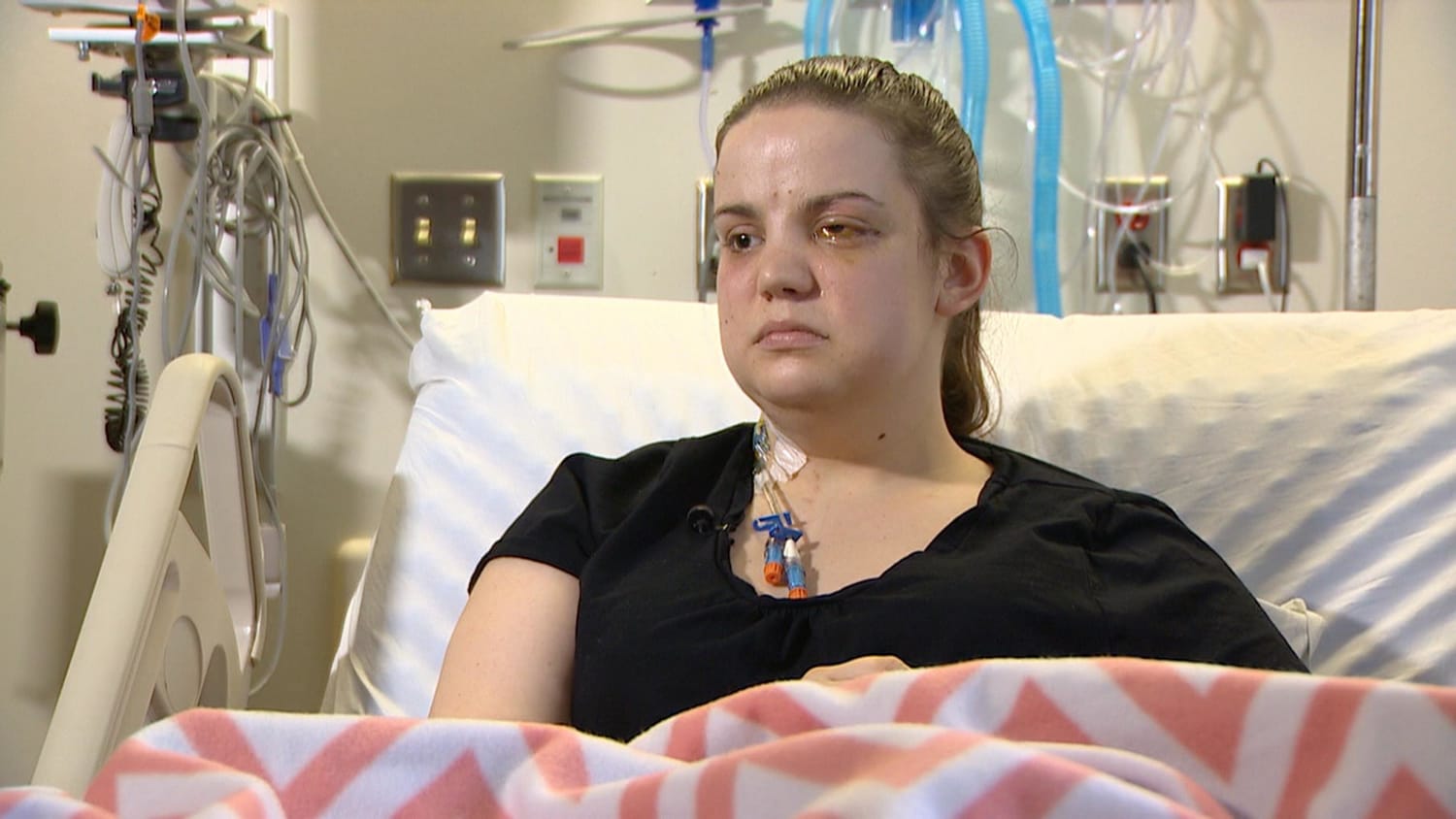 Survivor Unblurred Photos