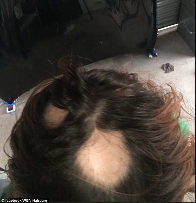 Popular Hair Product Line Wen Sued for Allegedly Making Women Go Bald