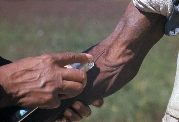 Syphilis In Black Men