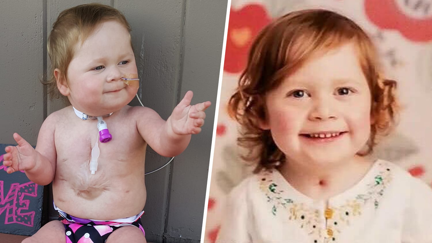 Ectopa Cordis Youtube