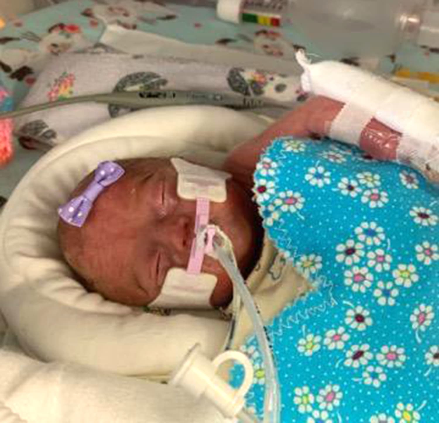 Baby Born At 30 Weeks Survival Rate