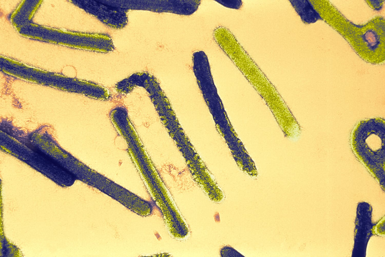 Marburg Symptoms Cdc