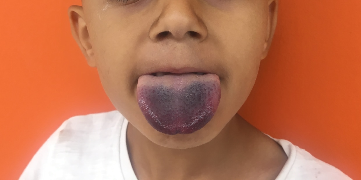 Male Tongue Trick