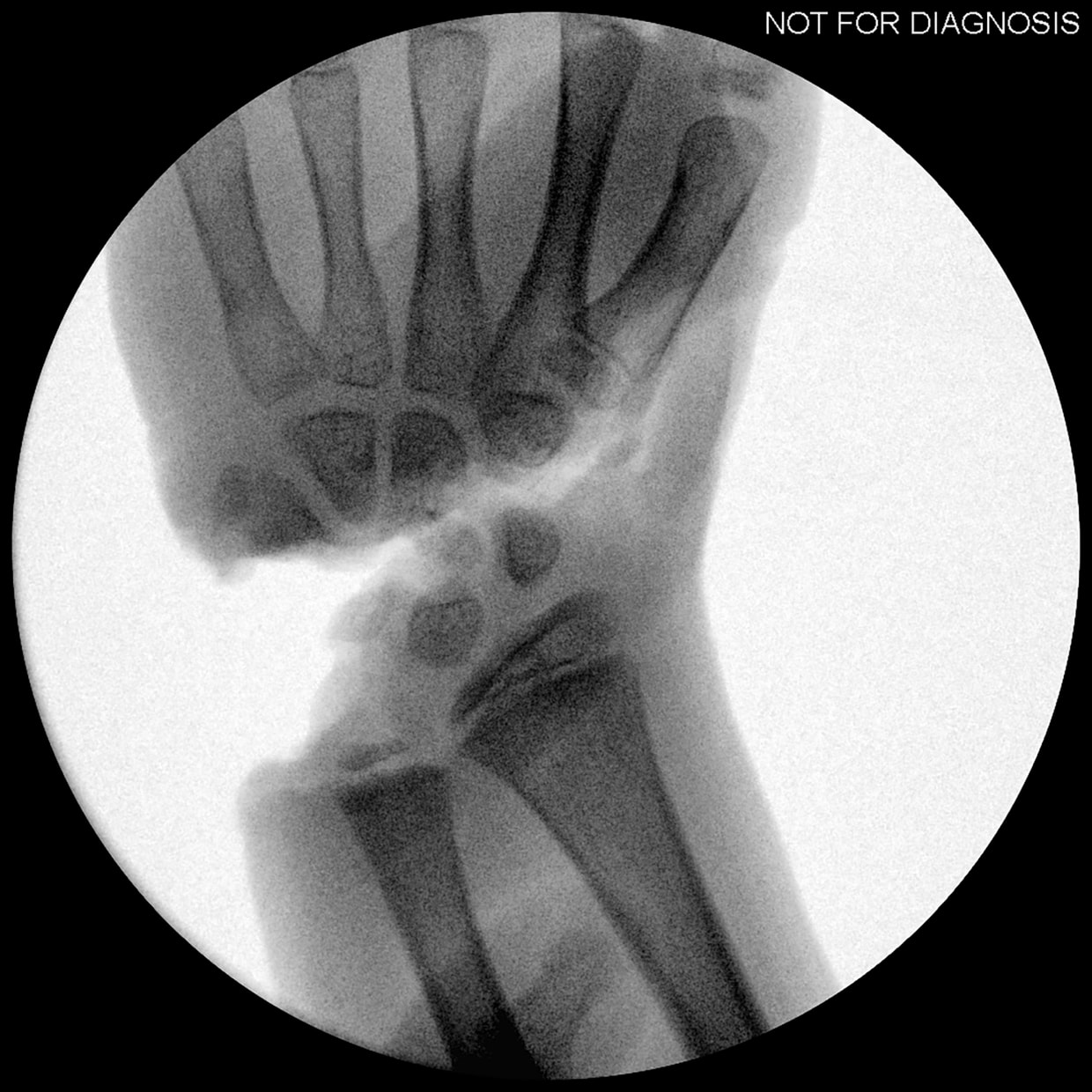 Florida girl, 9, recalls shark attack where she nearly lost hand – NBC ...