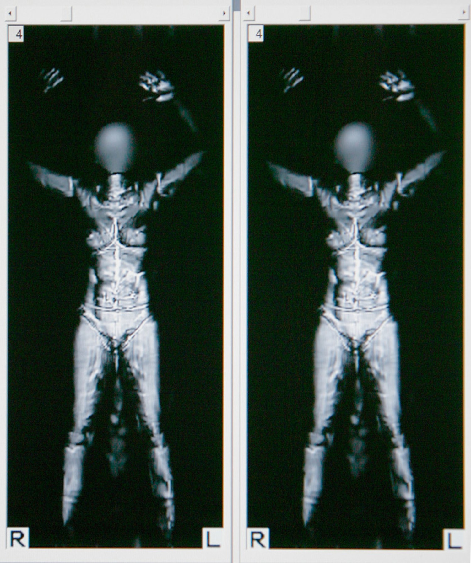 Jel B v l Mar Airplane Body Scanners Fert z Betegs g L that Tisztelet