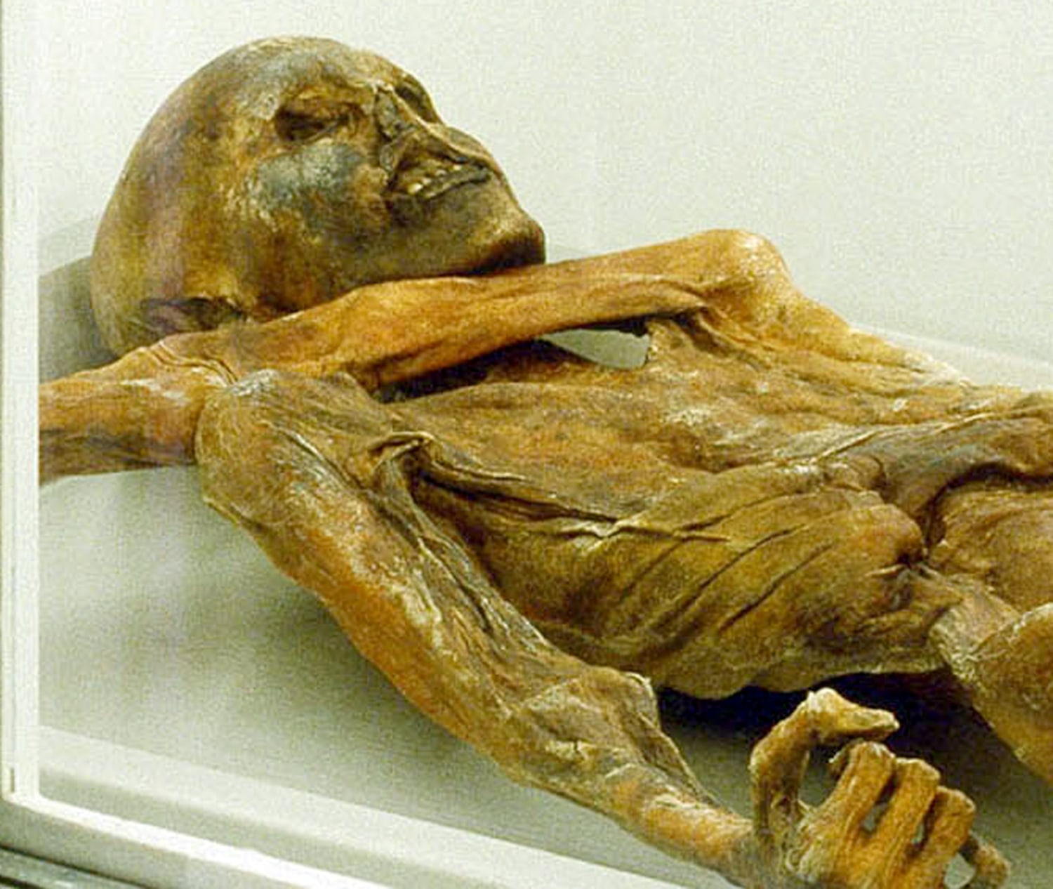 otzi mummy