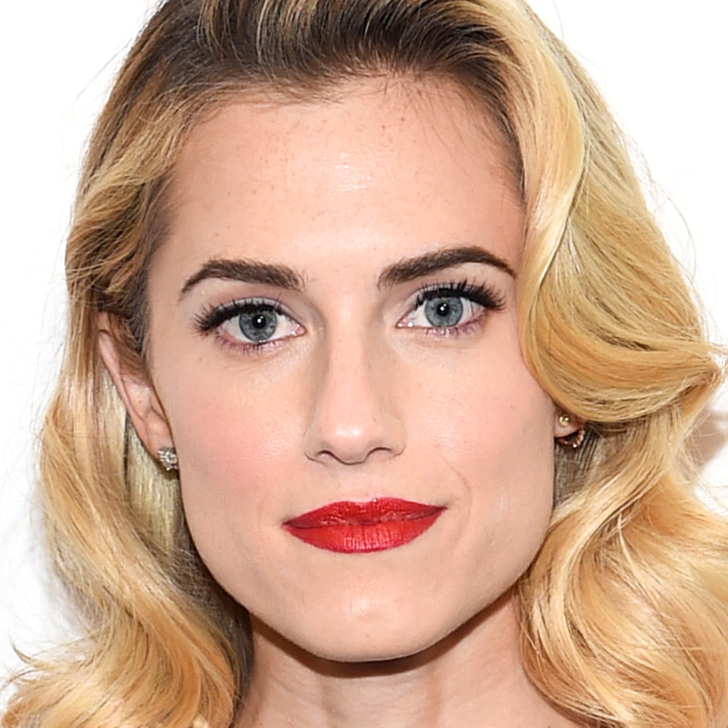 Allison Williams Plastica No Nariz Antes E Depois