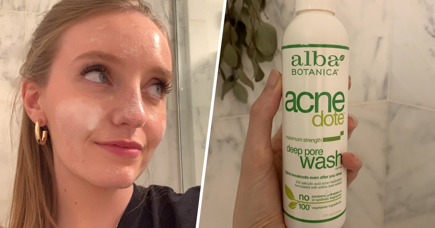 Alba Botanica Acnedote Maximum Strength Deep Pore Wash review
