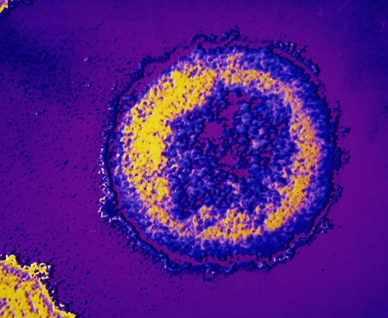 Viruses are harnessed to create their own energy