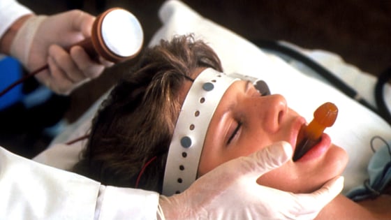 electroconvulsive shock therapy ect