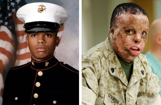 'Miracle' Marine loses final battle