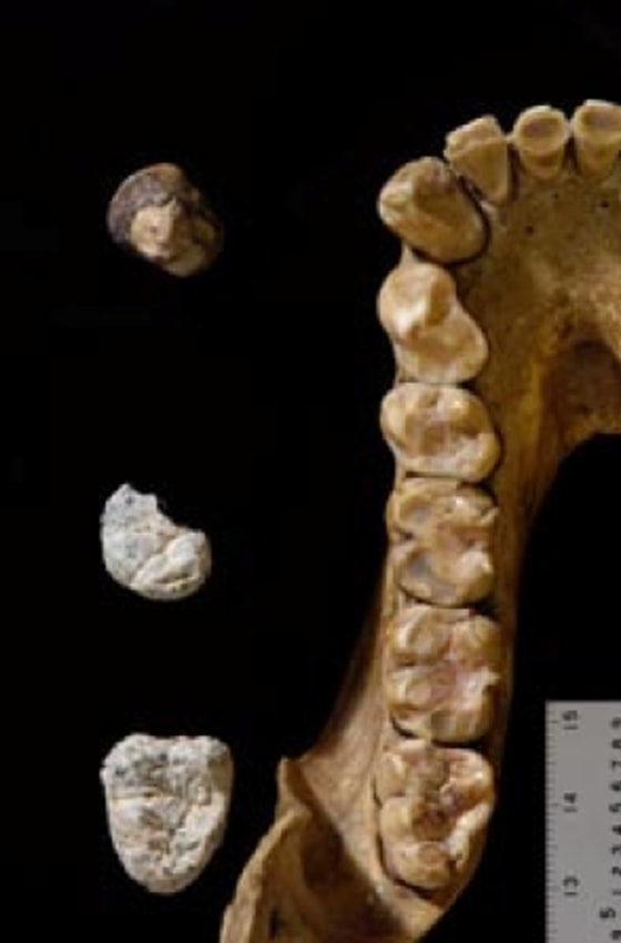 gorilla teeth structure