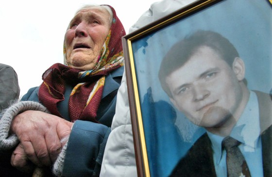 nuclear radiation burns chernobyl