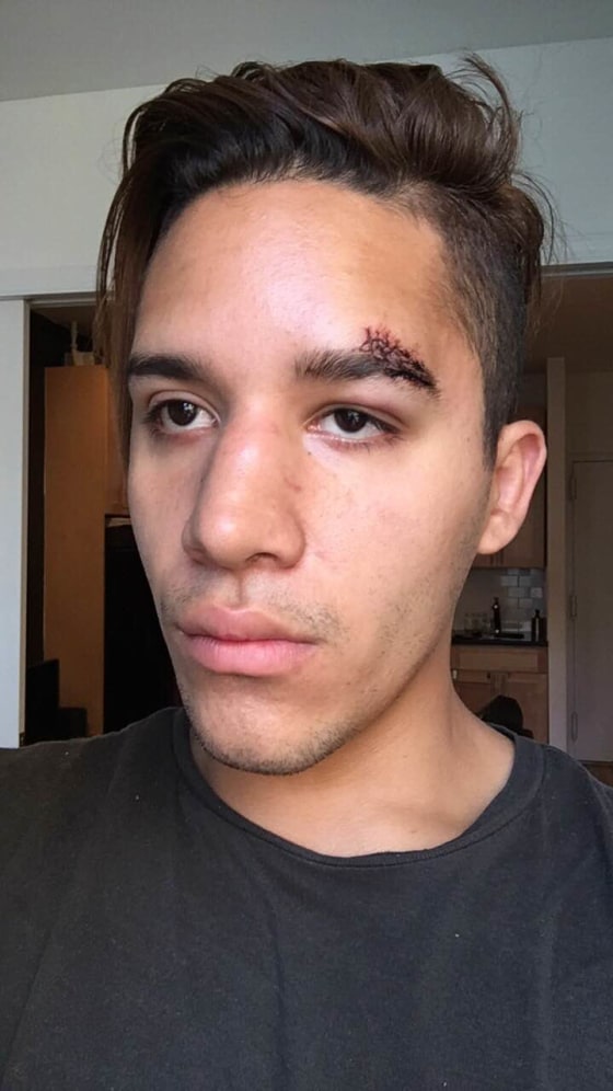 Gay Man Attacked in NYC Speaks Out