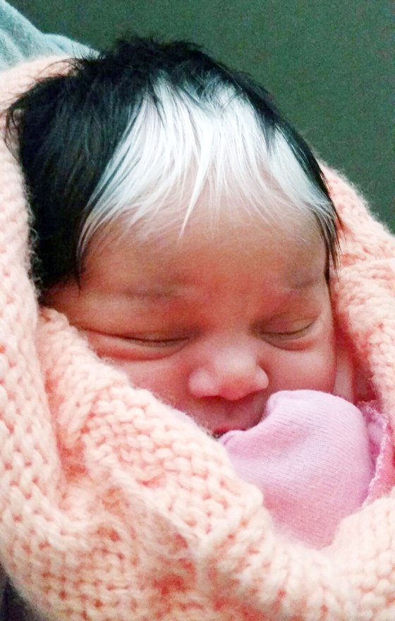 the baby inherited this "rare birthmark" from her mom : r/pics