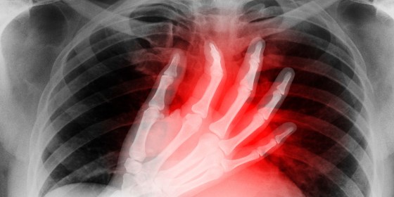 Heart Health Is Affected by Stress: How To Protect Yourself