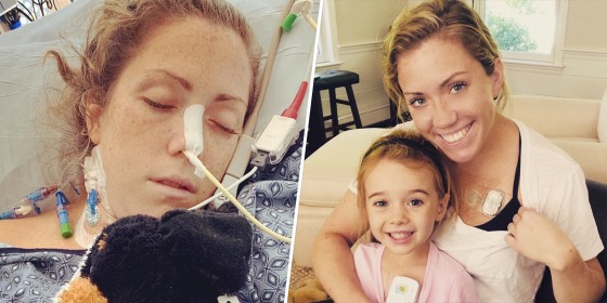 Woman, 29, Stroke Urges Others to Know Signs of Stroke, act FAST