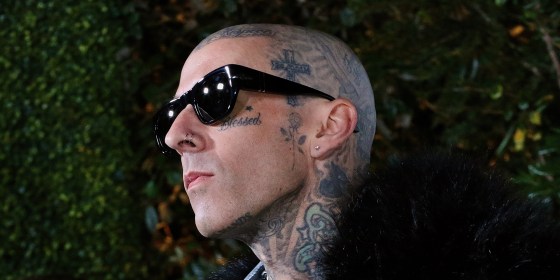 Travis Barker Gets Finger Surgery