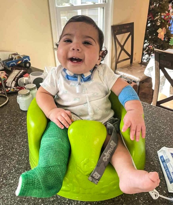 Deformed Babies From Smoking