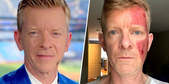 Sports Anchor Jamie Campbell Shares Photo of Pre-Skin Cancer Treatment