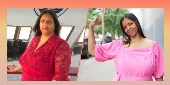 Breast Cancer Diagnosis, Bariatric Surgery Helps Mom Lose 110 Lbs