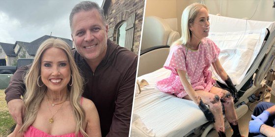 Woman's Arms, Legs Amputated After Sepsis Due To Strep Infection