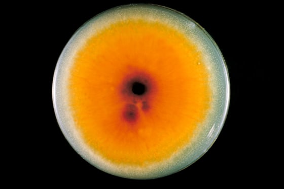 First case of a rare, sexually transmitted fungal infection reported in ...