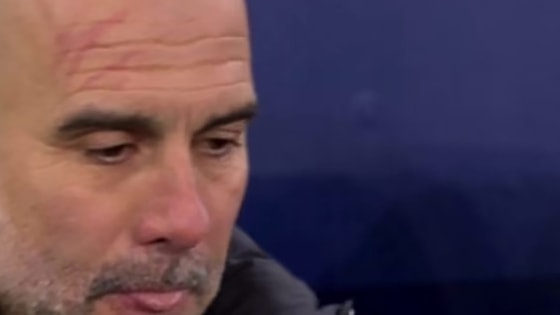Pep Guardiola vuelve a hacerse daño en la cabeza
