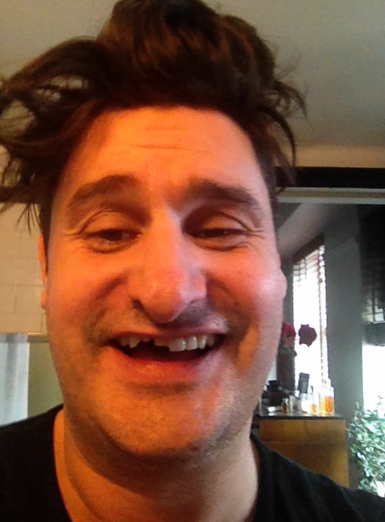 Rob Shuter loses his tooth; KLG and Hoda laugh hysterically