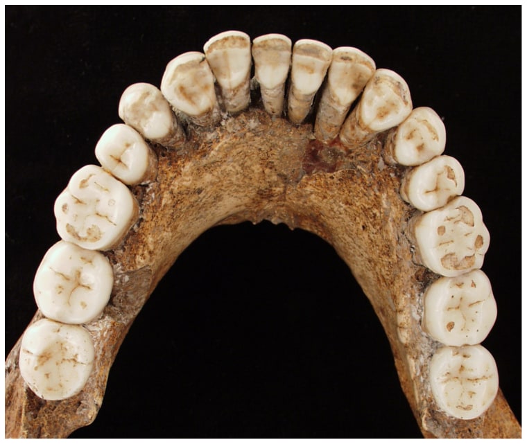 Most Neanderthals were right-handed like us, researchers find