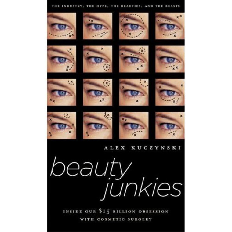 ellen barkin plastic surgery