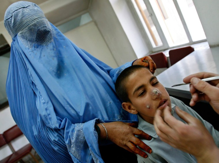 Disfiguring skin disease plagues Afghanistan