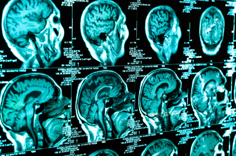 Diet Supplement Can t Cure Concussions FDA diet-supplement-can-t-cure-concussions-fda