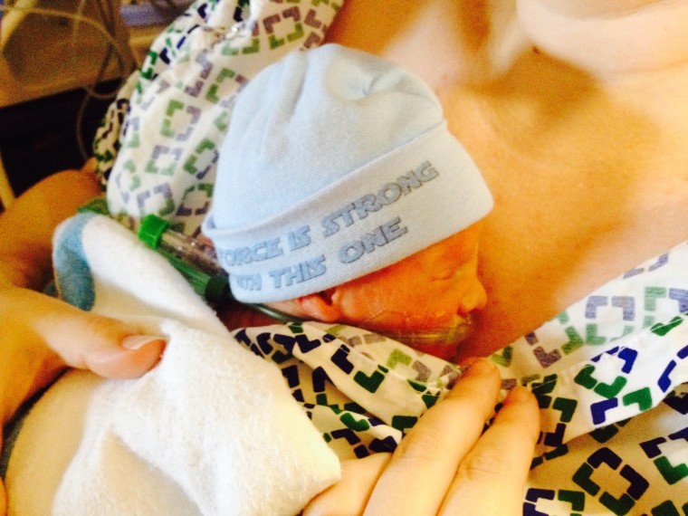 Mom gives birth while diagnosed with AVM, rare brain condition