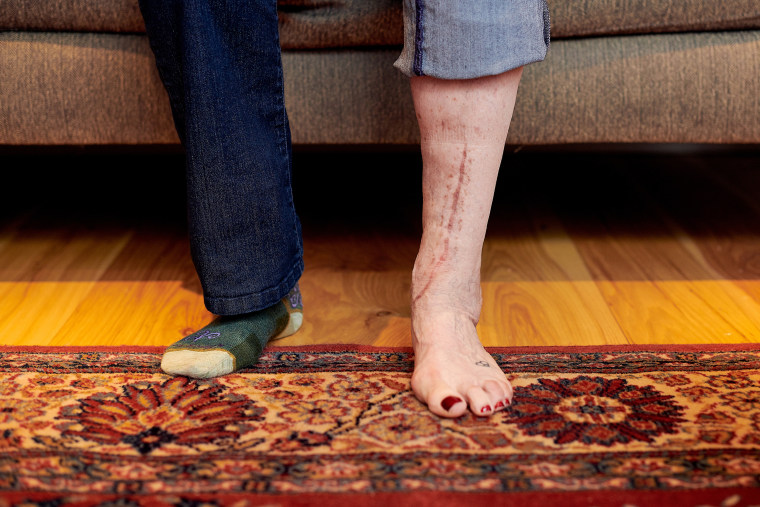 After her skiing accident, an uphill battle over snowballing bills