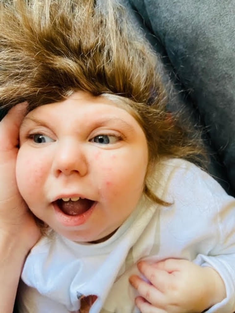 Jaxon Buell Jaxon Strong Boy Born With Part Of Brain Missing Dies At 5