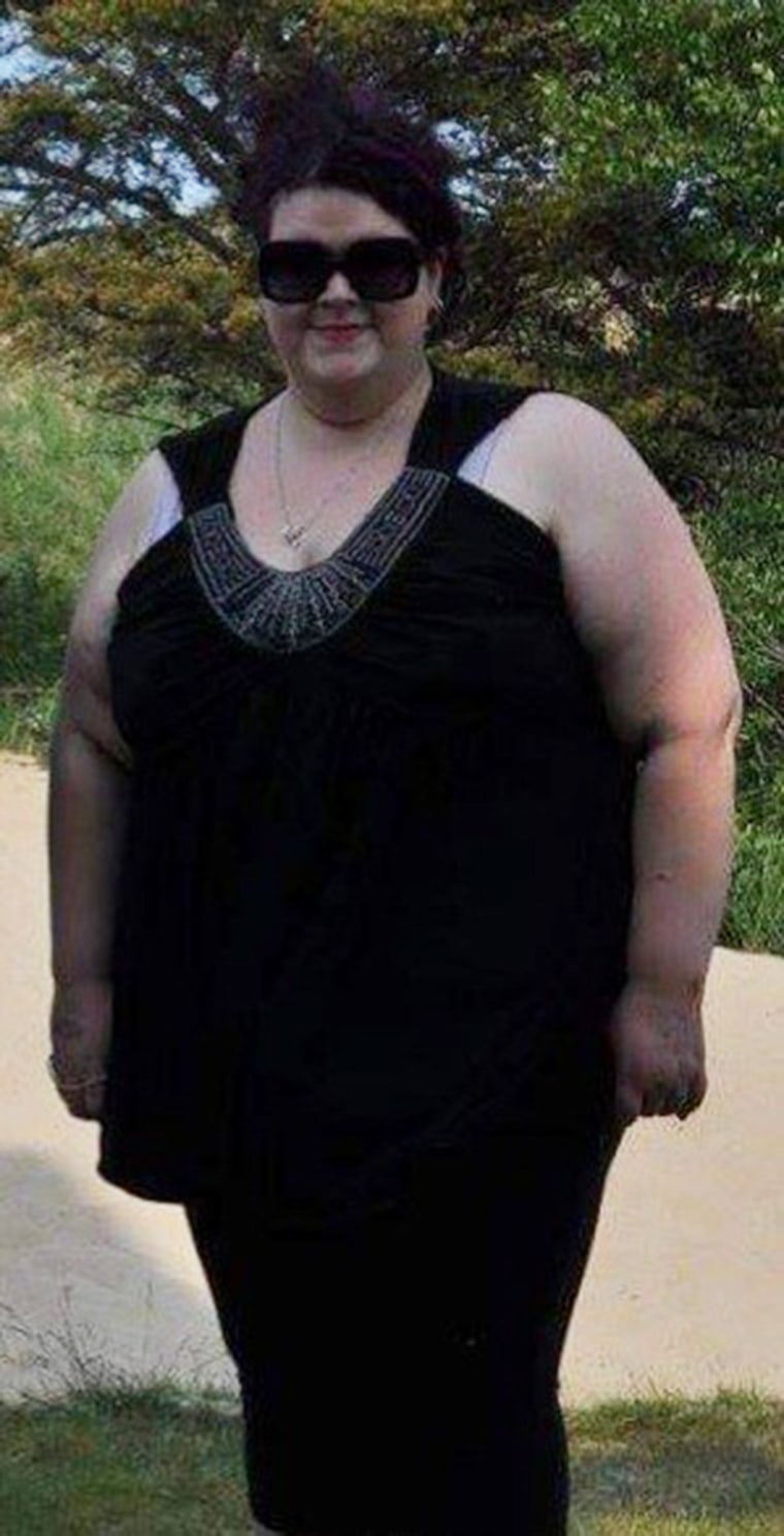 Woman Loses 215 Pounds Hopes To Lose 100 More Pounds Woman Loses 215 Pounds Hopes To Lose 100 More Pounds