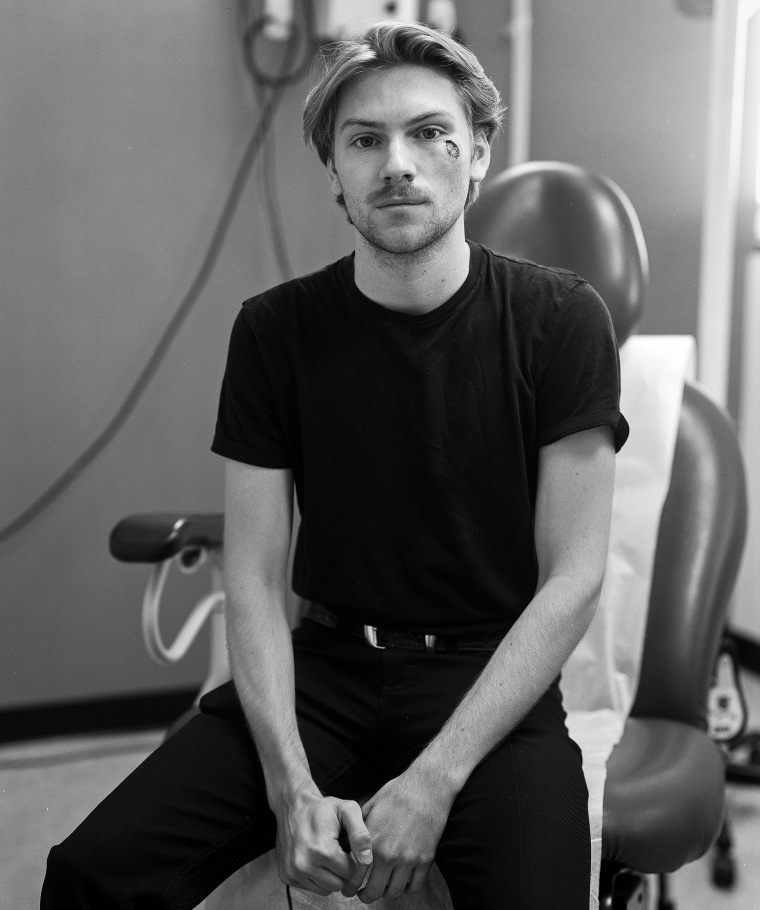 Man, 21, Photographs His Basal Cell Skin Cancer Symptoms, Surgery