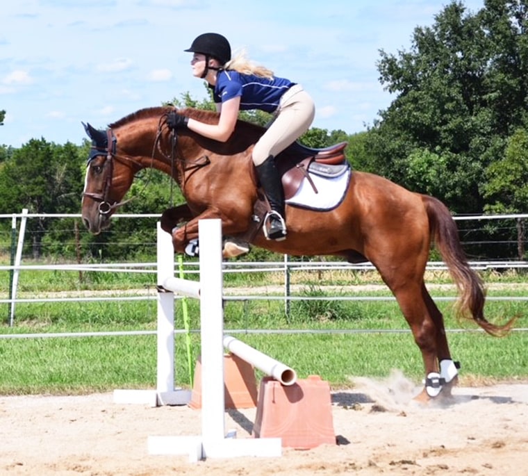 Insoportables migrañas de una adolescente ayudan a detectar tumor