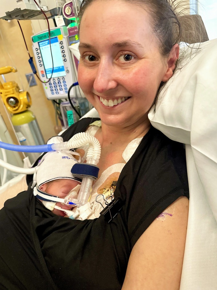 Pregnant Woman's Strep Infection Worsens, Leads To Amputation