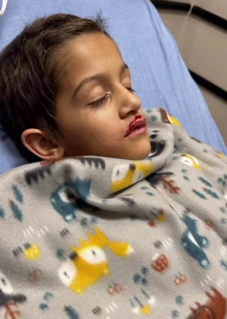 Boy, 7, Injured By Falling Drone, Needs Emergency Heart Surgery