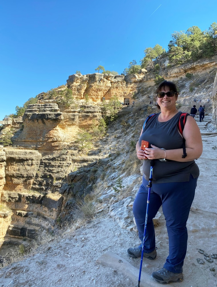 Couple Loses 300 Pounds Together With 1 Weight-Loss Procedure