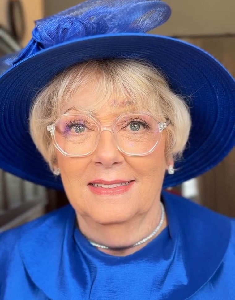 Makeup Artist Helps Woman Transform for Daughter's Wedding After 'Devastating' Fall