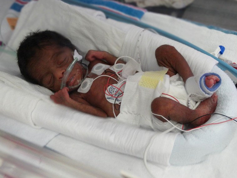 Mom Becomes A NICU Nurse After Being Grateful For Child's Nurses