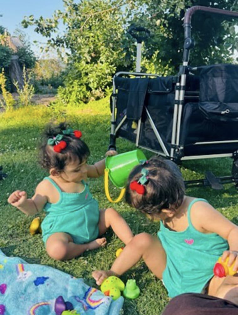 15-Month-Old Conjoined Twins Successfully Separated After 18-Hour Surgery