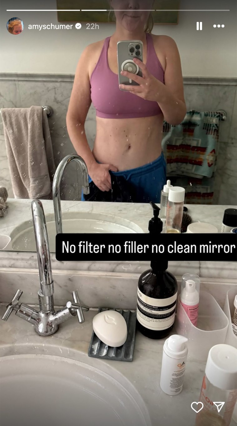 Amy Schumer Displays Abs on Instagram After Taking Mounjaro