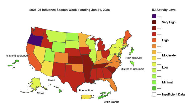 Is Flu Season 2026 Hitting a 2nd Wave? Know These Symptoms, Doctors Say